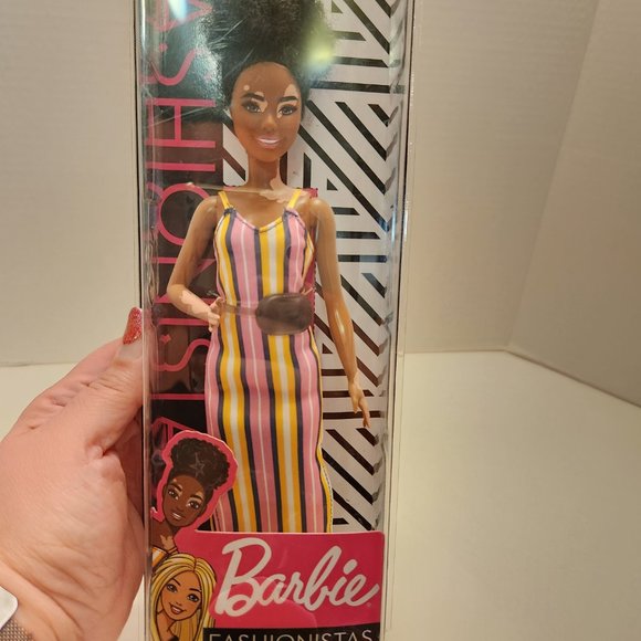 Barbie | Toys | Barbie Fashionista 35 Doll With Vitiligo Curly Hair ...